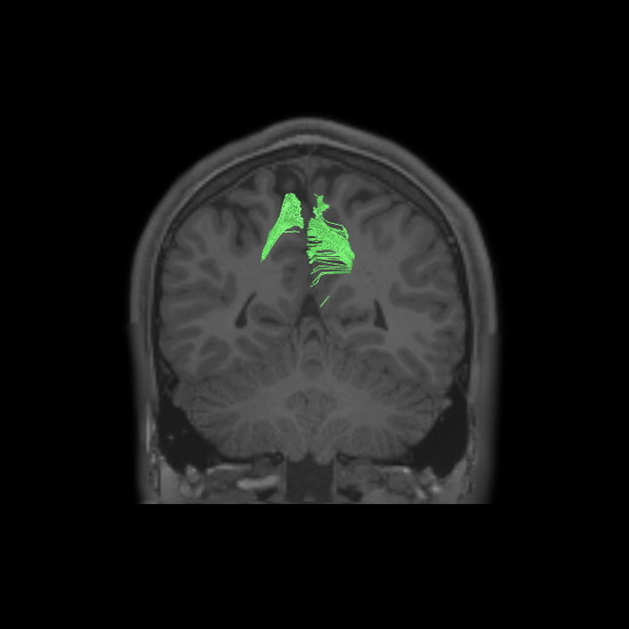 Ventral Attention Network - Connectome Guide