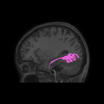 Visual System - Connectome Guide