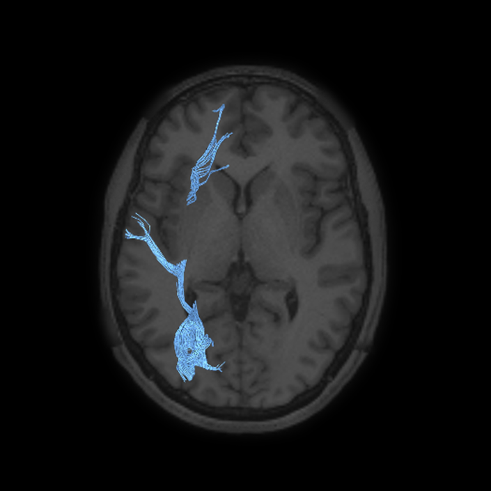 Visual System - Connectome Guide