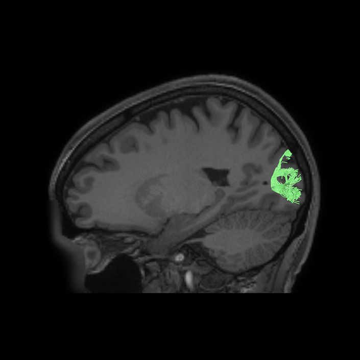 Visual System - Connectome Guide