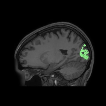 Visual System - Connectome Guide