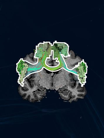 Sensorimotor System - Connectome Guide