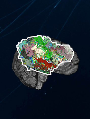 Ventral Attention Network - Connectome Guide